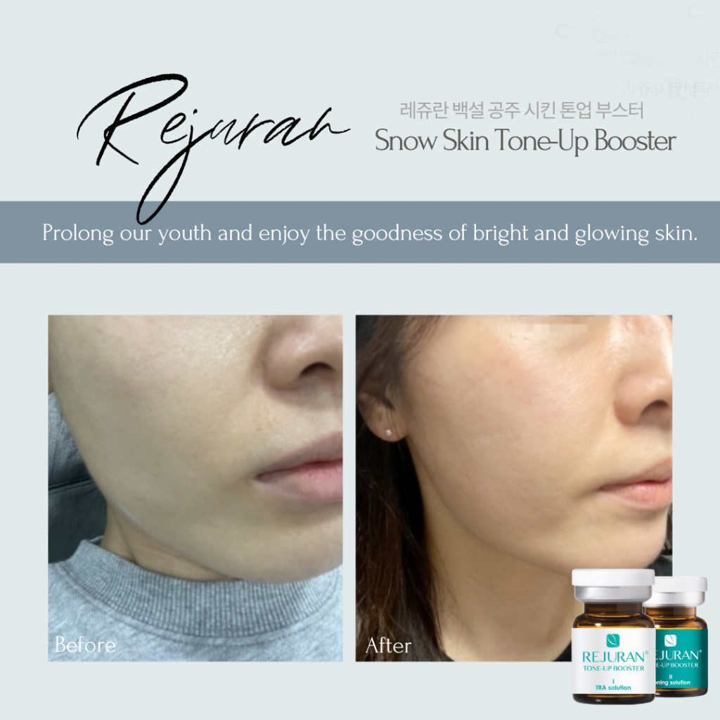 Rejuran Synergy Tone Up Booster – SKINMART