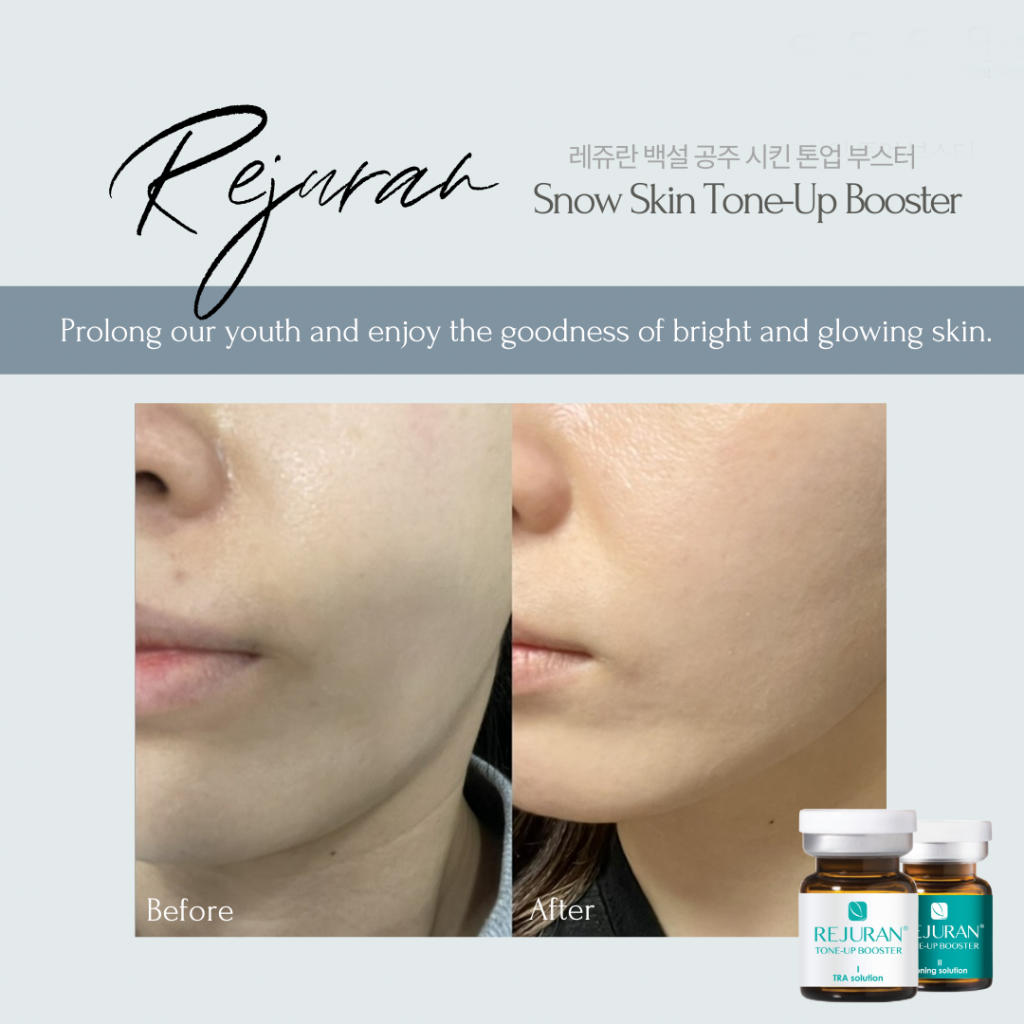 Rejuran Synergy Tone Up Booster – SKINMART