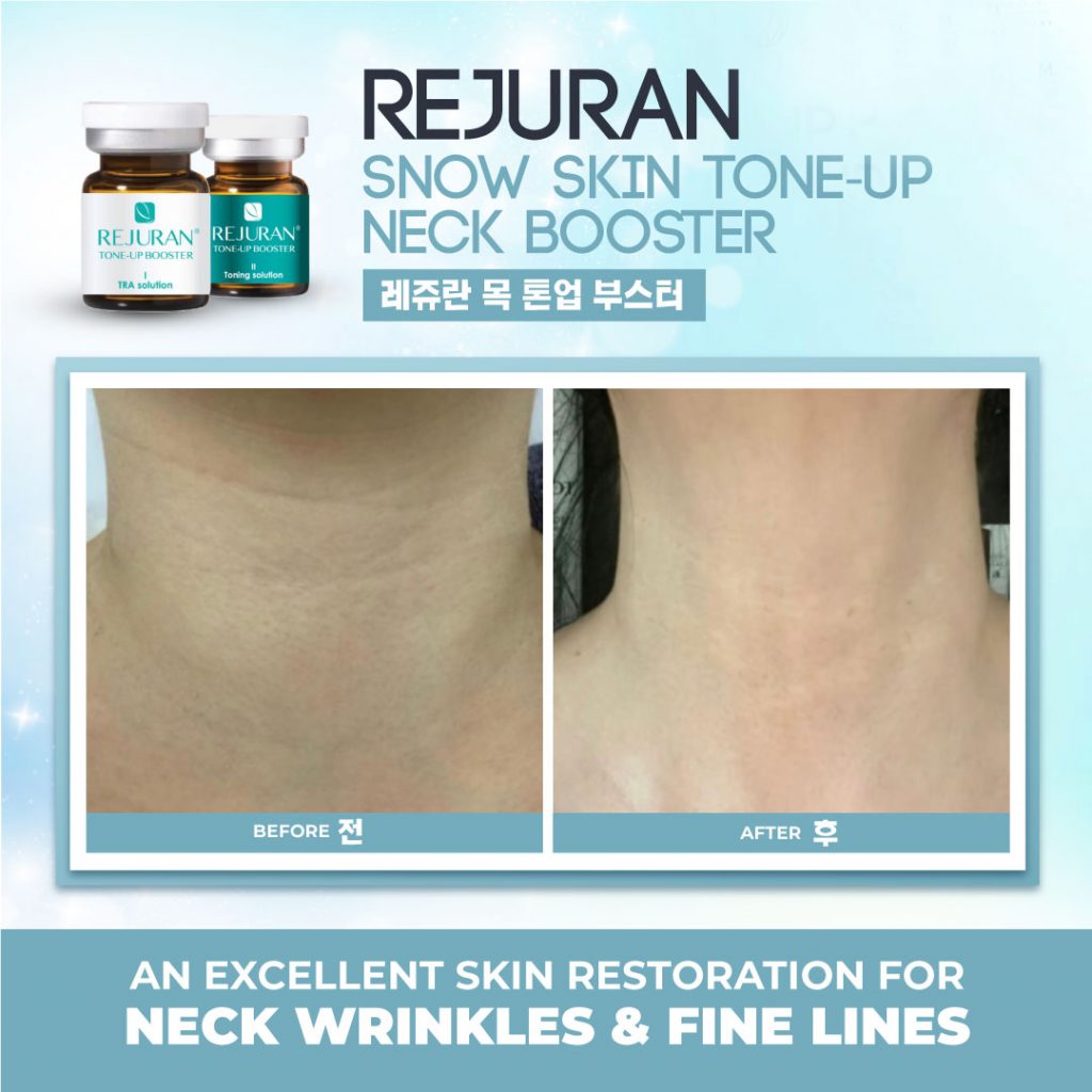 Rejuran Synergy Tone Up Booster – SKINMART