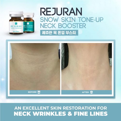 Rejuran Synergy Tone Up Booster – SKINMART